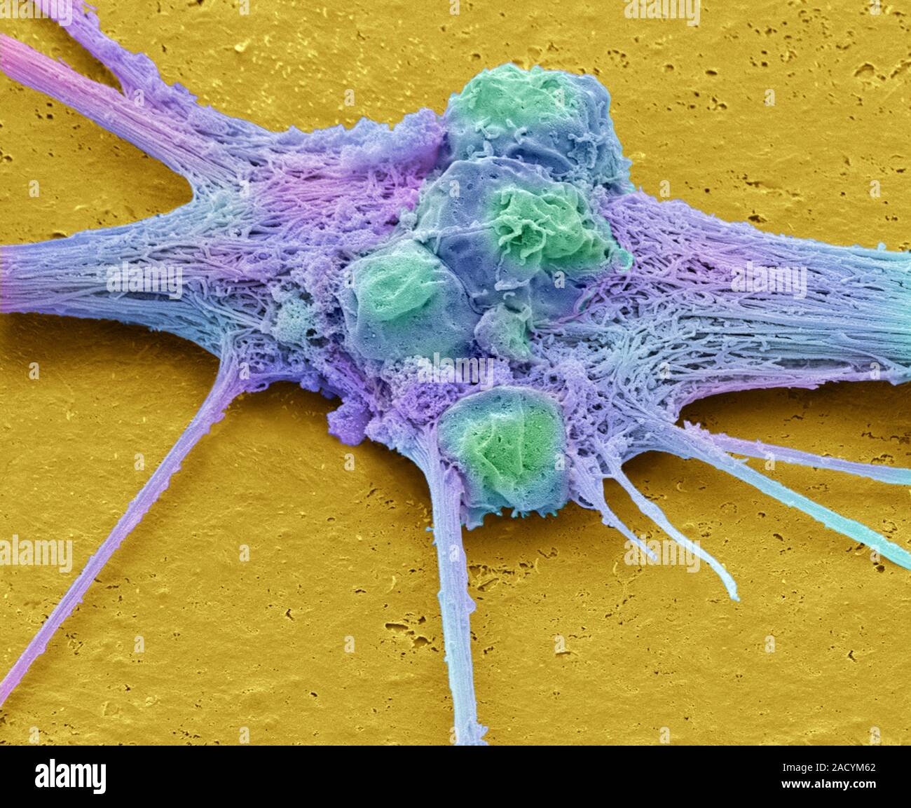 Stem cell-derived neuron. Coloured scanning electron micrograph (SEM ...