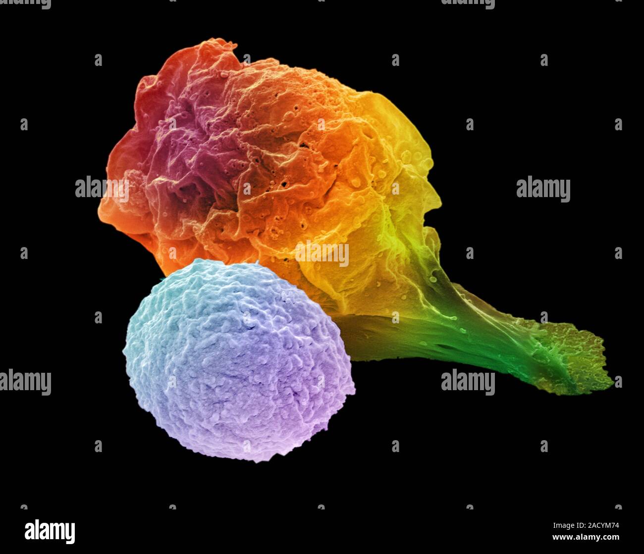 T lymphocyte and lymphoma cancer cell. Coloured scanning electron ...