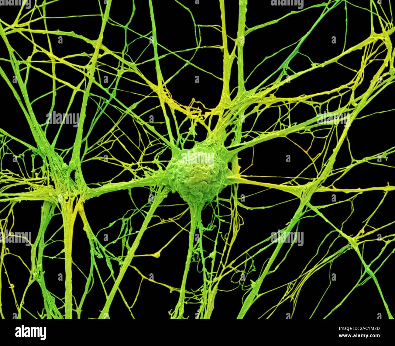 Stem cell-derived neuron. Coloured scanning electron micrograph (SEM ...