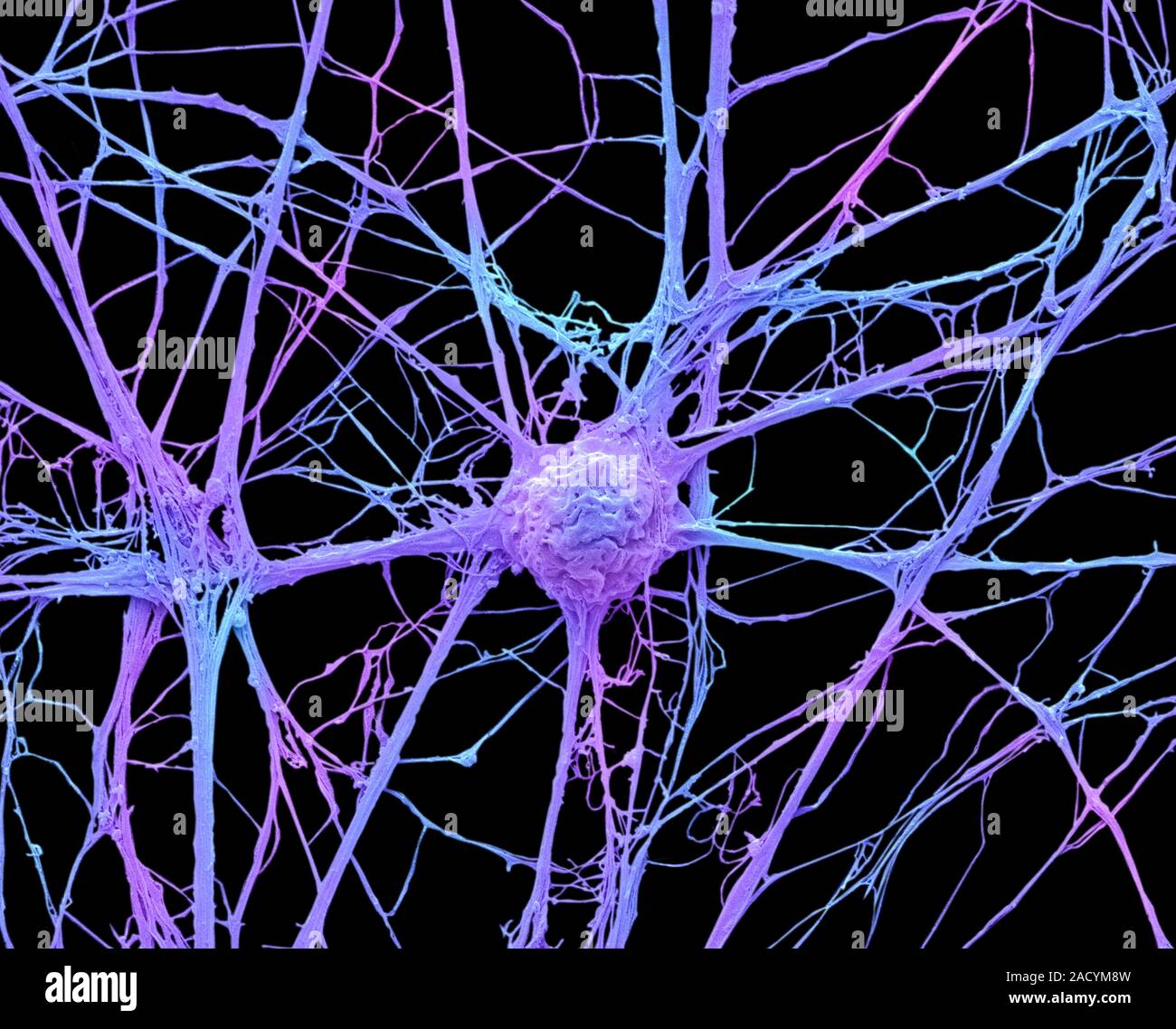 Stem cell-derived neuron. Coloured scanning electron micrograph (SEM ...