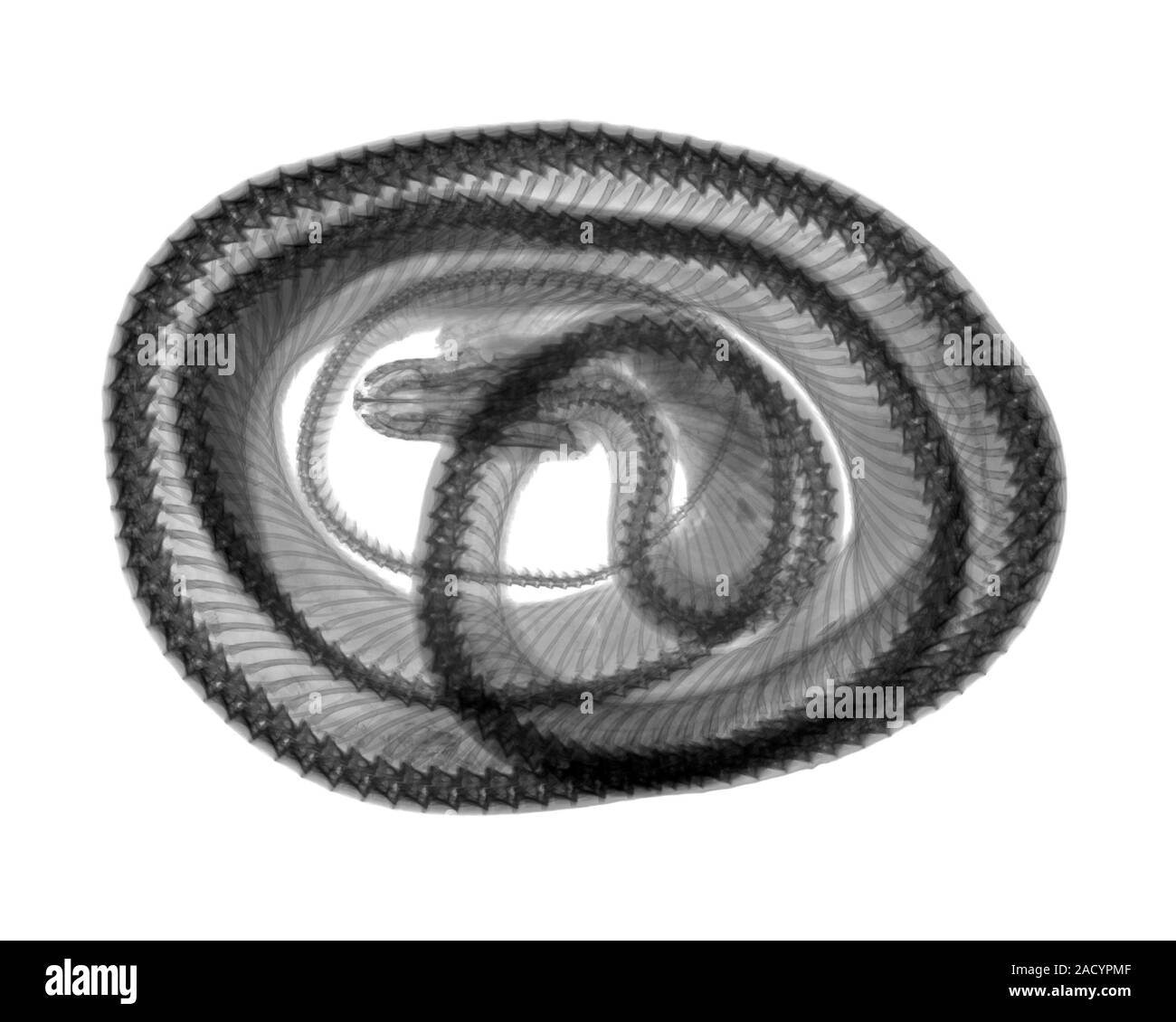 Snake, X-ray. The snake's skull is at centre, attached to the top of a ...