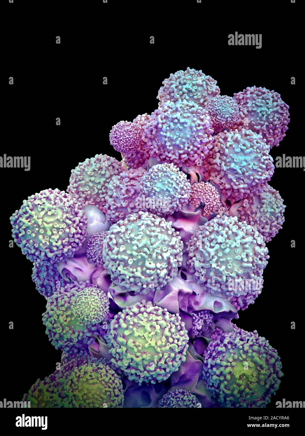 Cancer cells, illustration. Cancerous (malignant) cells divide rapidly ...