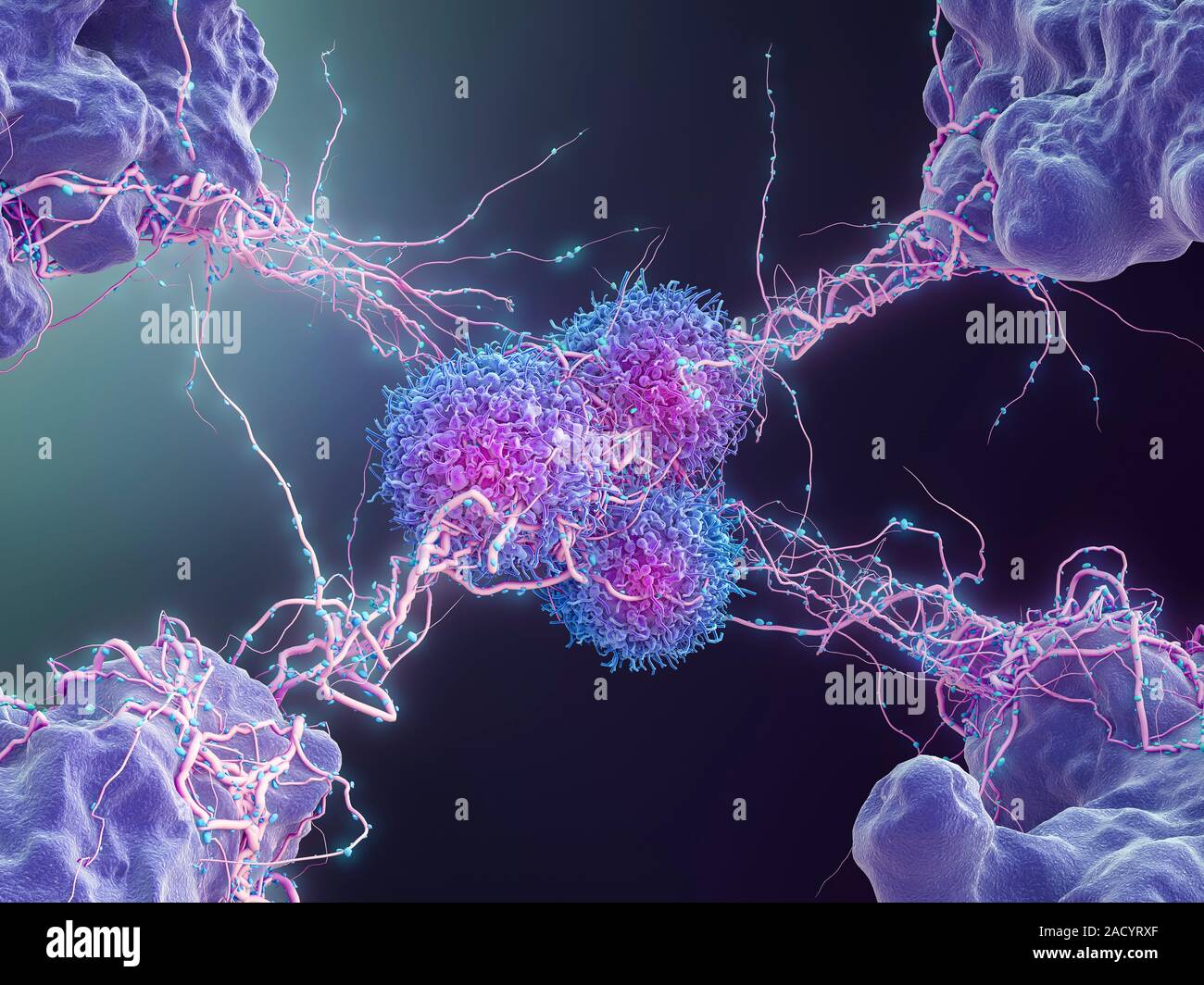 Cancer cells, illustration. Cancerous (malignant) cells divide rapidly ...