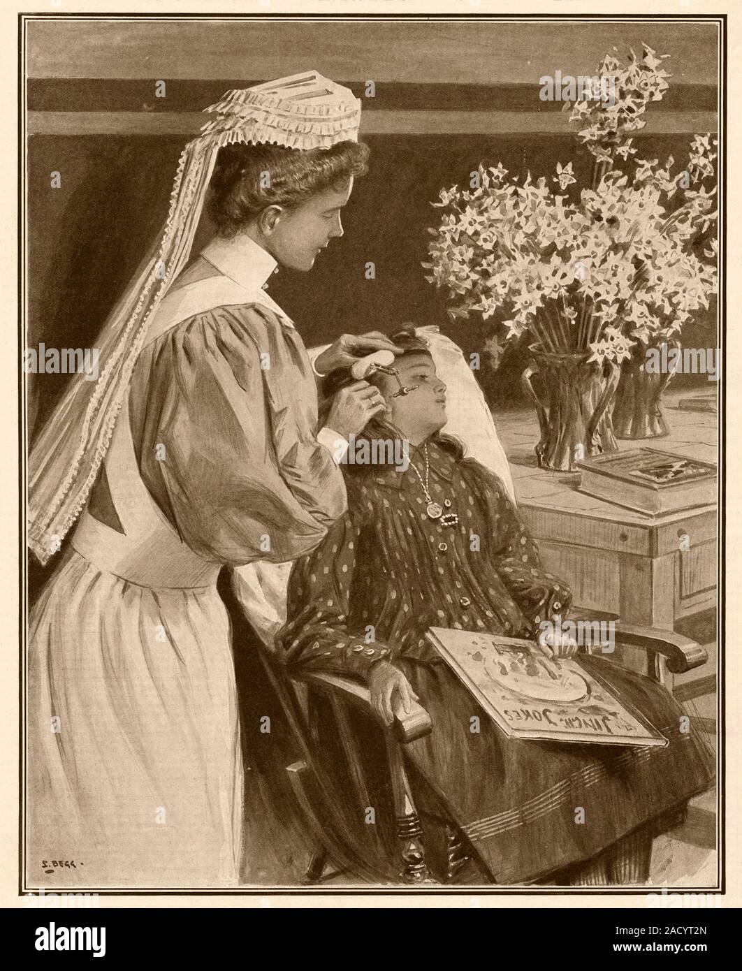 Radium birthmark treatment. Illustration of the therapeutic use of the ...