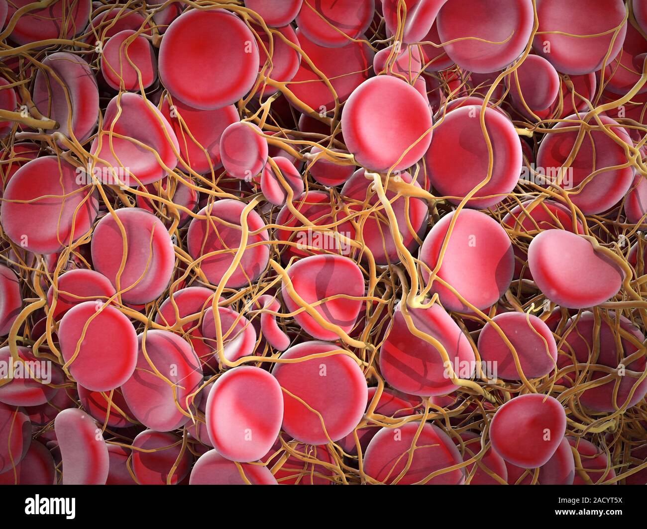 Blood clot, illustration. Red blood cells (erythrocytes) are trapped ...