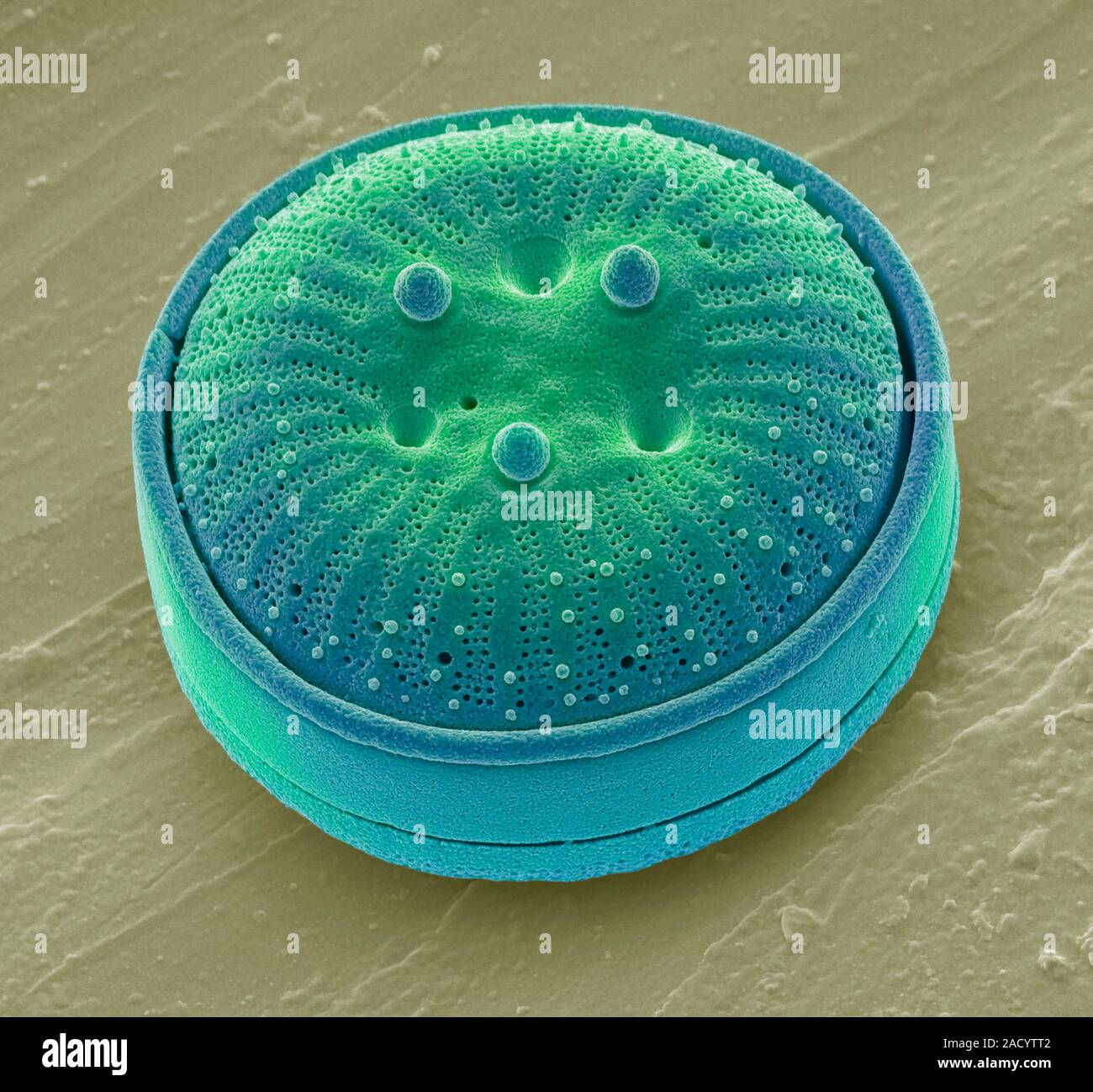 Diatom. Coloured scanning electron micrograph (SEM) of a single diatom ...