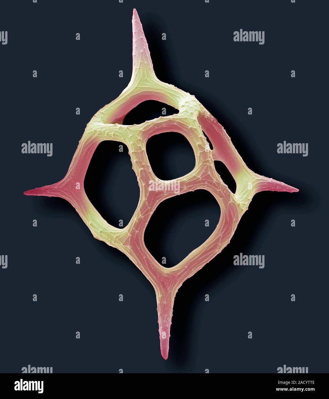 Silicoflagellate. Coloured scanning electron micrograph (SEM) of the ...