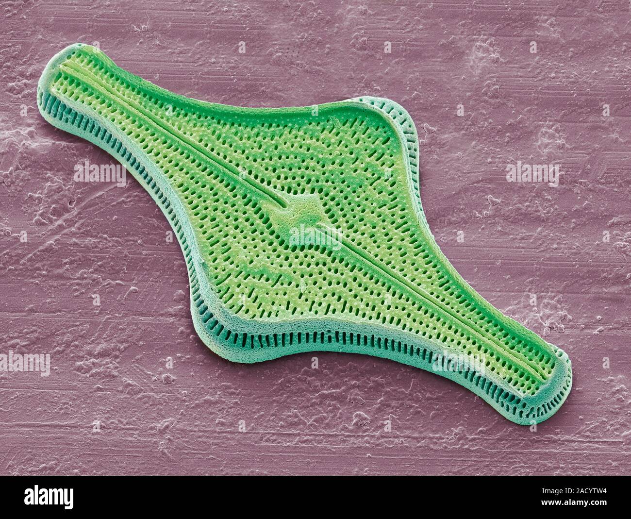 Diatom (Navicula sp.). Coloured scanning electron micrograph (SEM) of a ...
