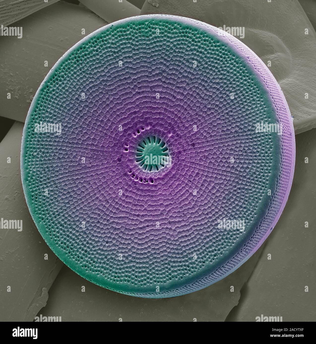 Diatom (Eupodiscus sp.). Coloured scanning electron micrograph (SEM) of ...