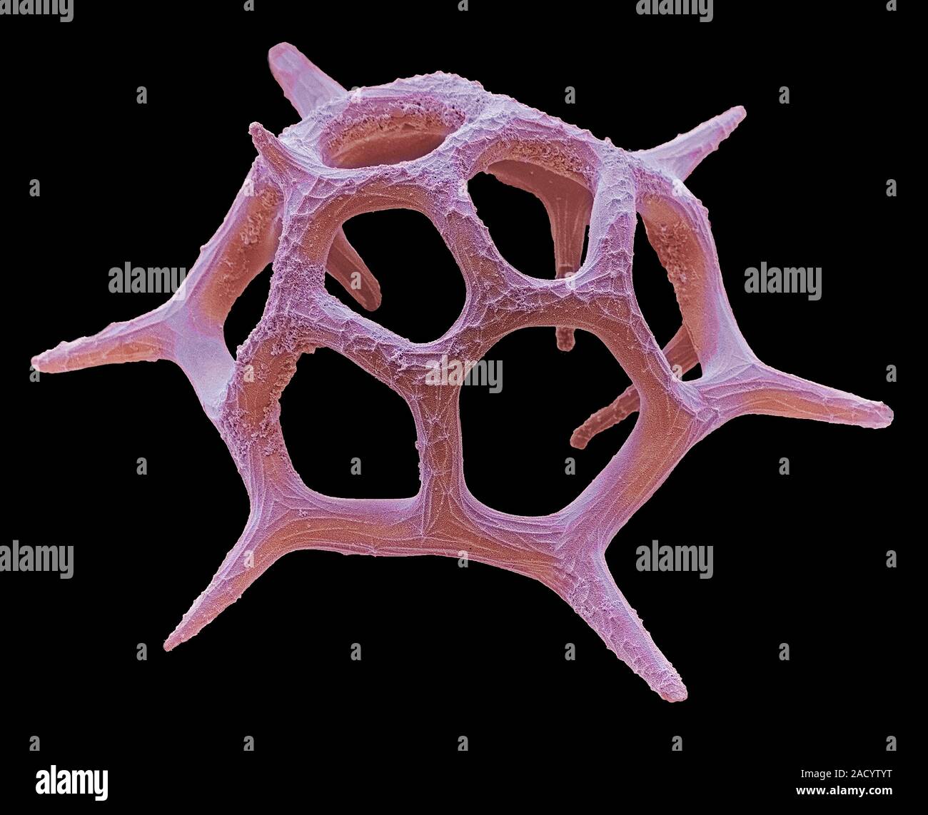 Silicoflagellate. Coloured scanning electron micrograph (SEM) of the ...