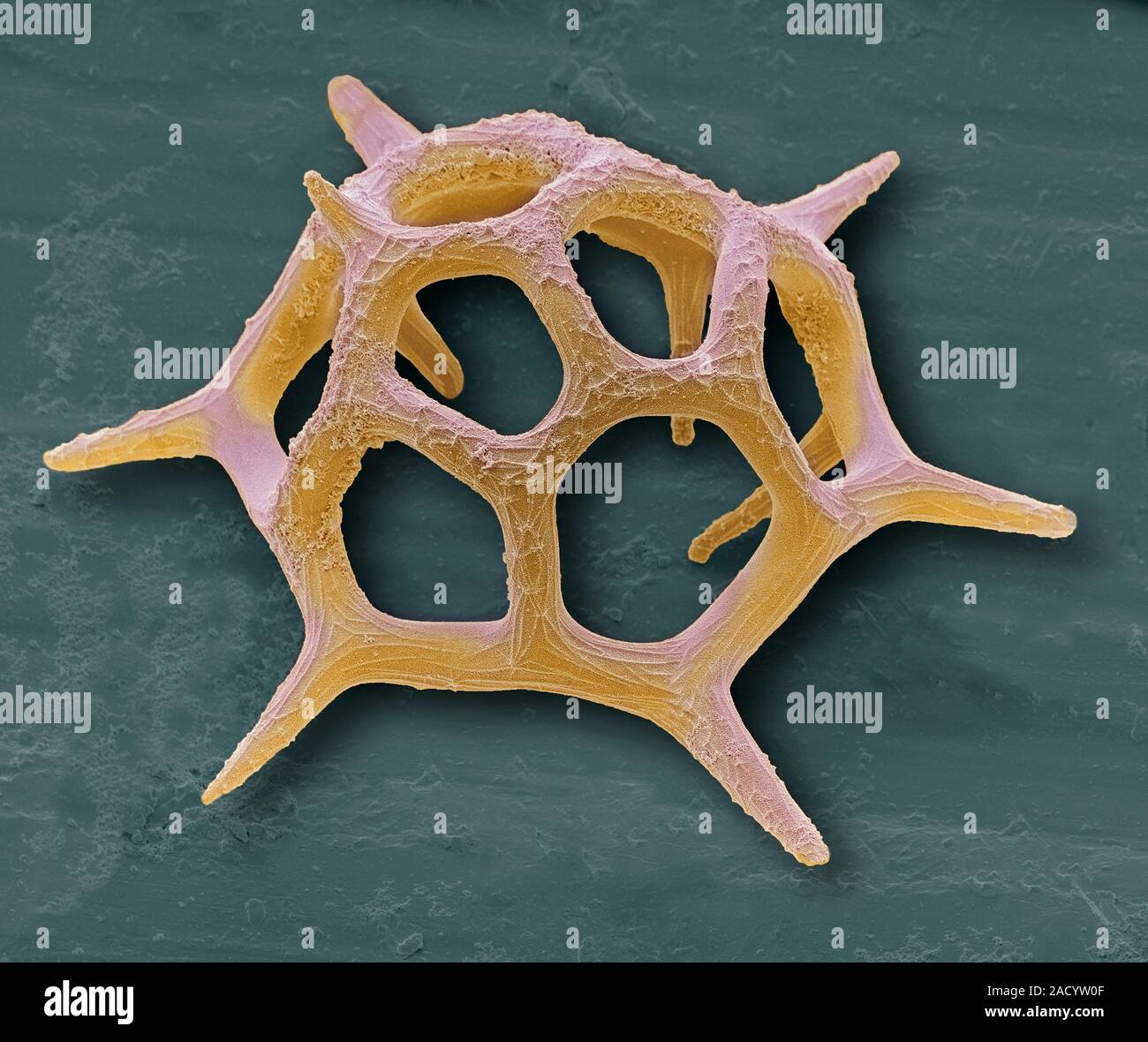 Silicoflagellate. Coloured scanning electron micrograph (SEM) of the ...