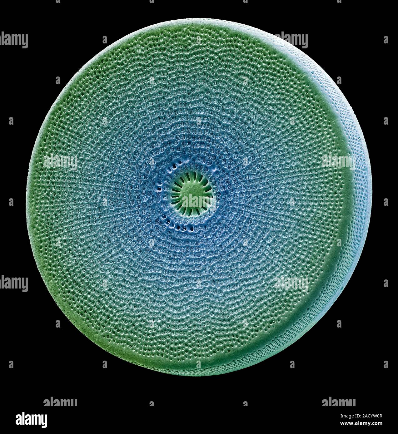 Diatom (Eupodiscus sp.). Coloured scanning electron micrograph (SEM) of ...
