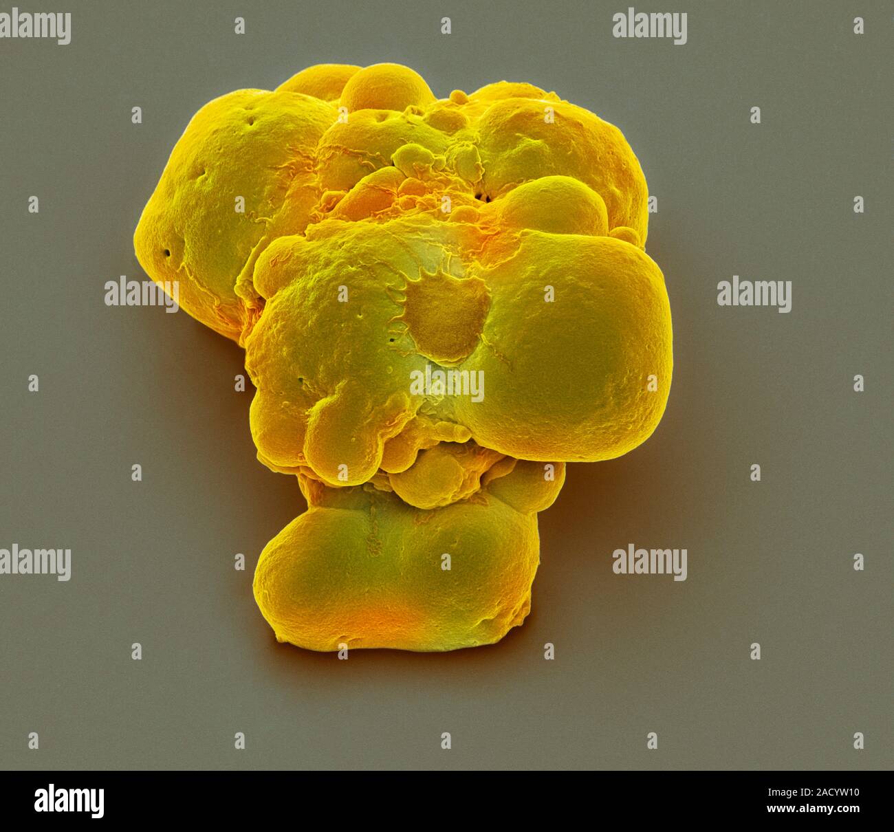 Pluripotent stem cells, Coloured scanning electron micrograph (SEM) of ...