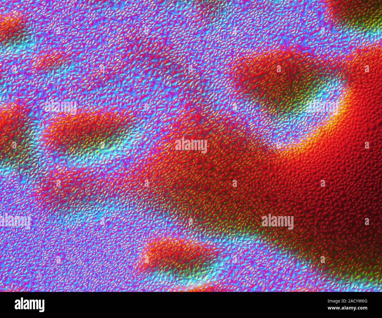 Polarised light micrograph of crystals of vitamin B12 (cyanocobalamin ...