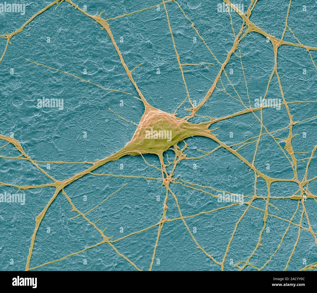 Stem cell-derived motor neuron. Coloured scanning electron micrograph ...