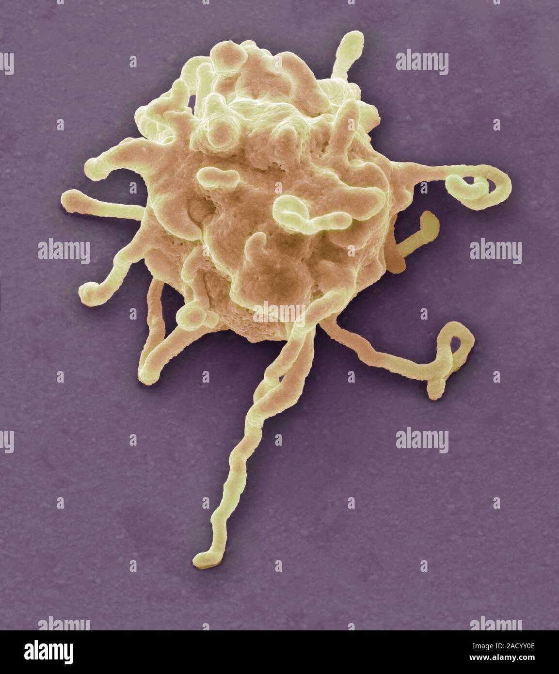 Activated platelet, coloured scanning electron micrograph (SEM ...