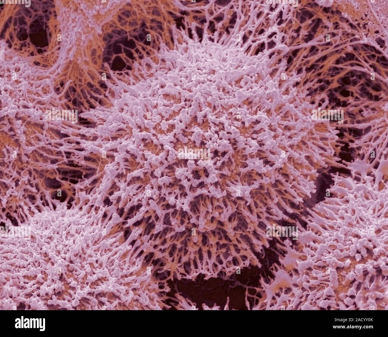 Colonial freshwater alga. Coloured scanning electron micrograph (SEM ...