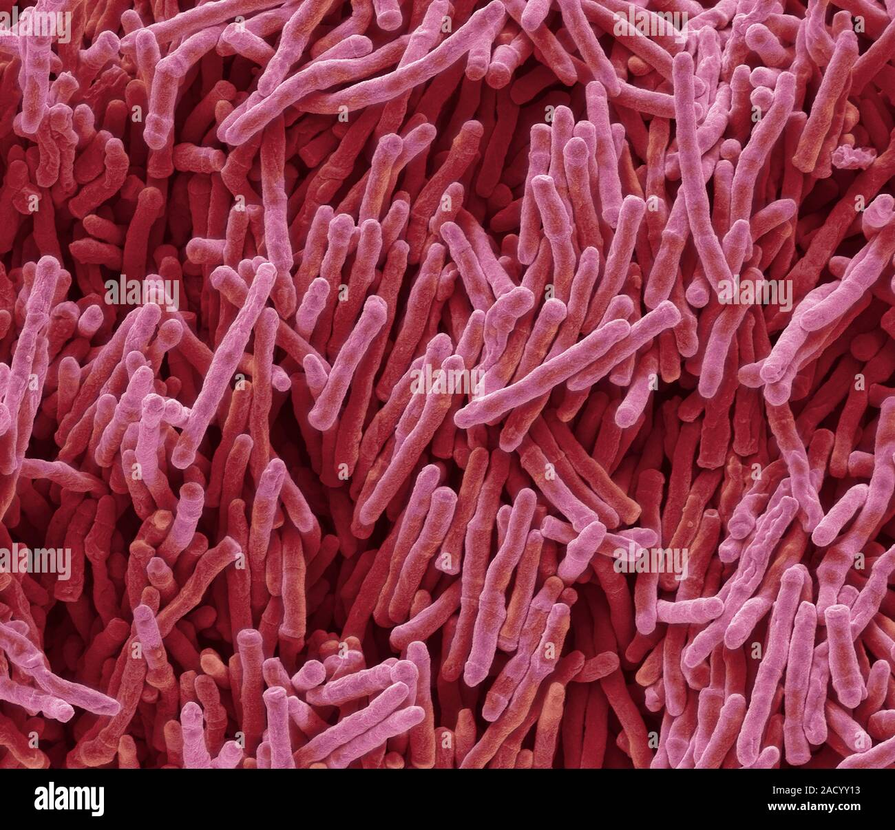 Is Mycobacterium Smegmatis Gram Positive Or Negative