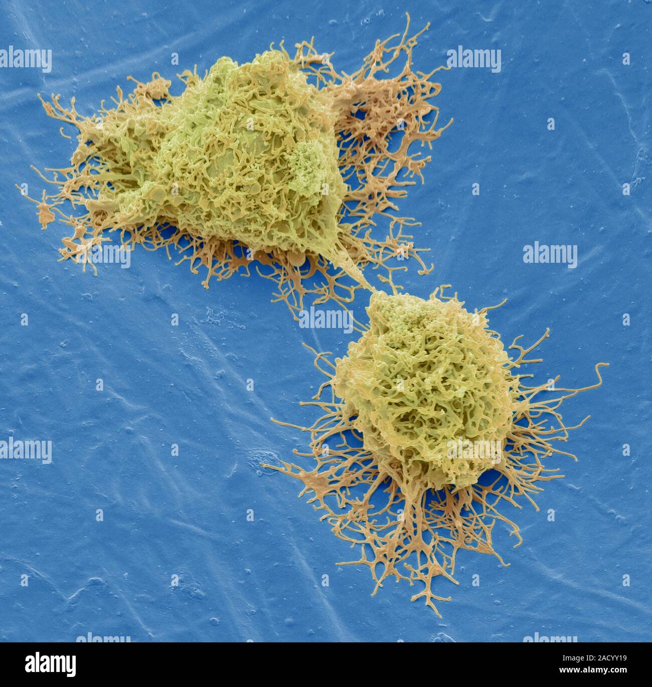 Mesenchymal stem cells. Coloured scanning electron micrograph (SEM) of ...