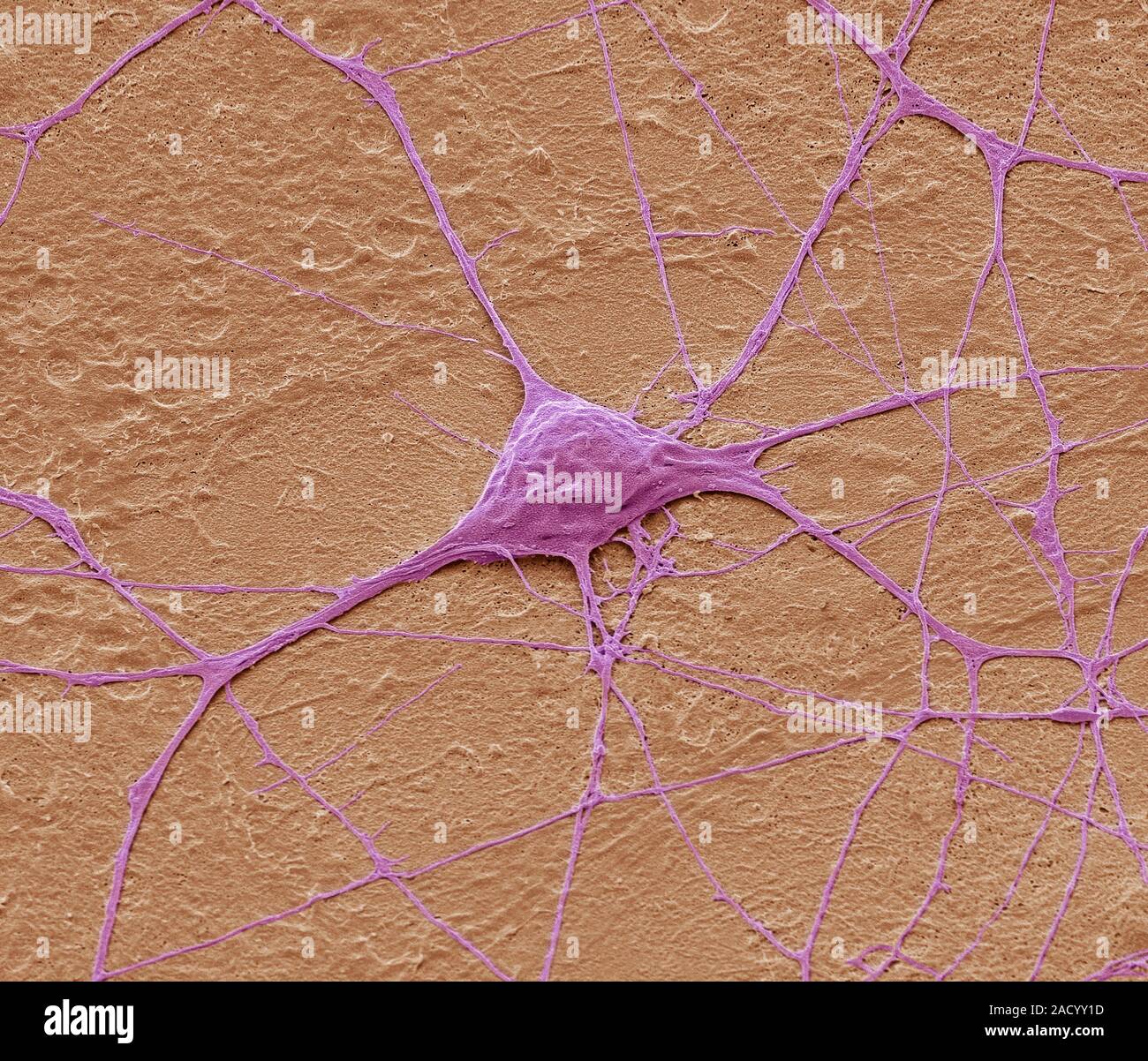 Stem cell-derived motor neuron. Coloured scanning electron micrograph ...