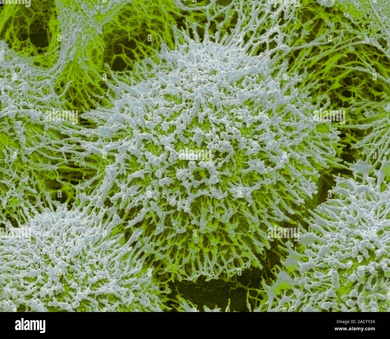 Colonial freshwater alga. Coloured scanning electron micrograph (SEM ...