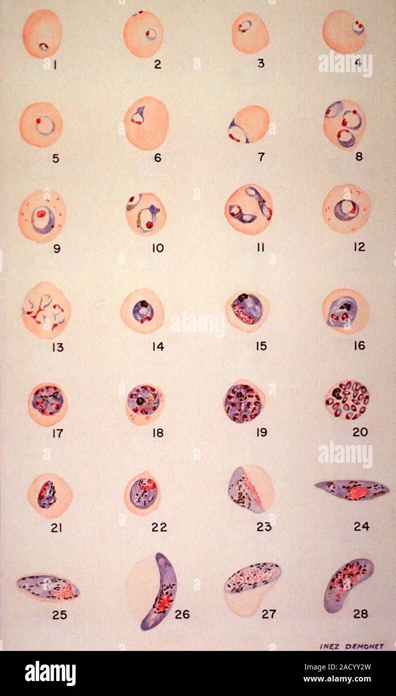 Malaria parasite growth. Illustration showing the stages of growth of ...