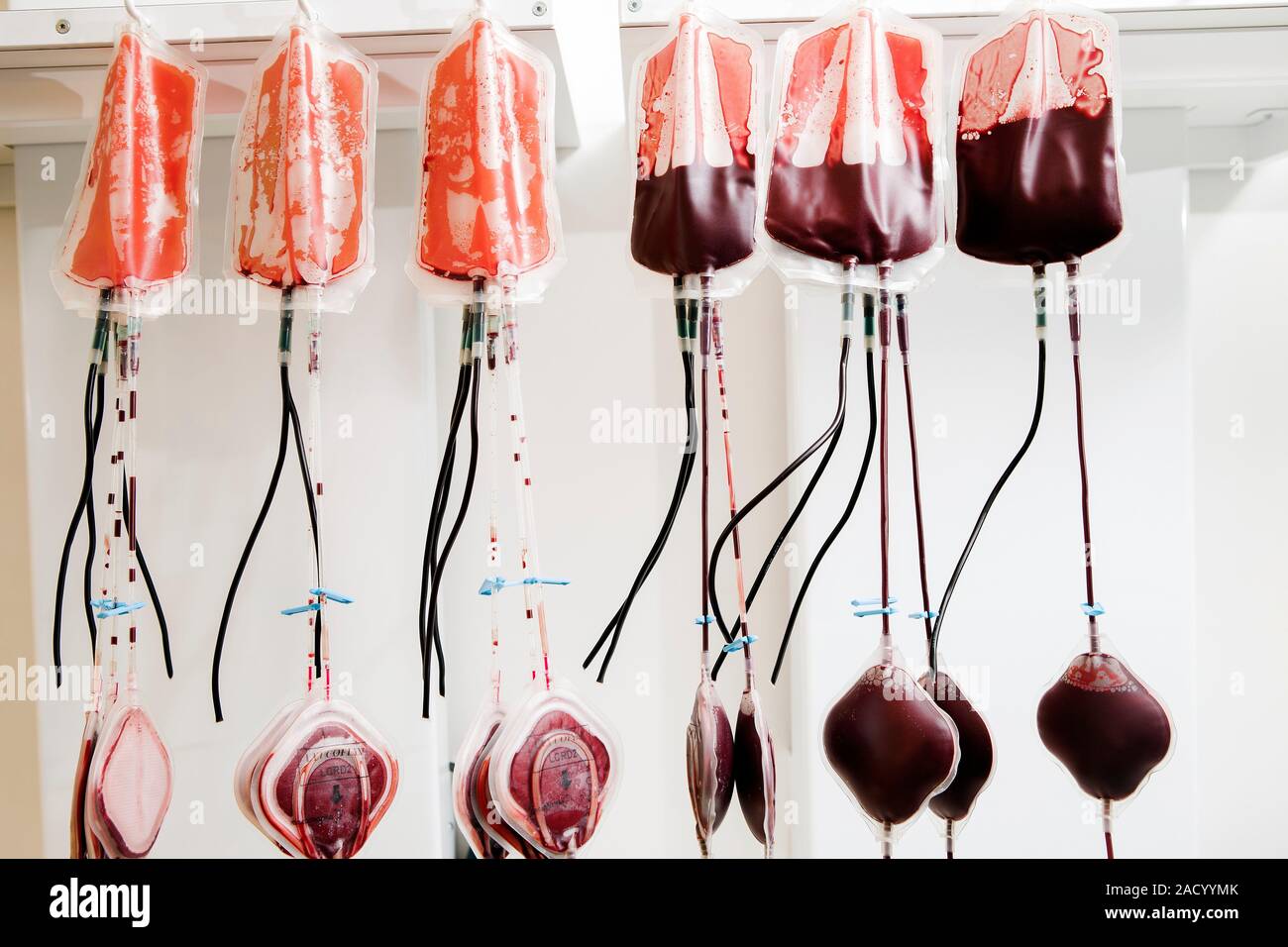 Blood donation clinic. Donated blood being separated in a blood ...