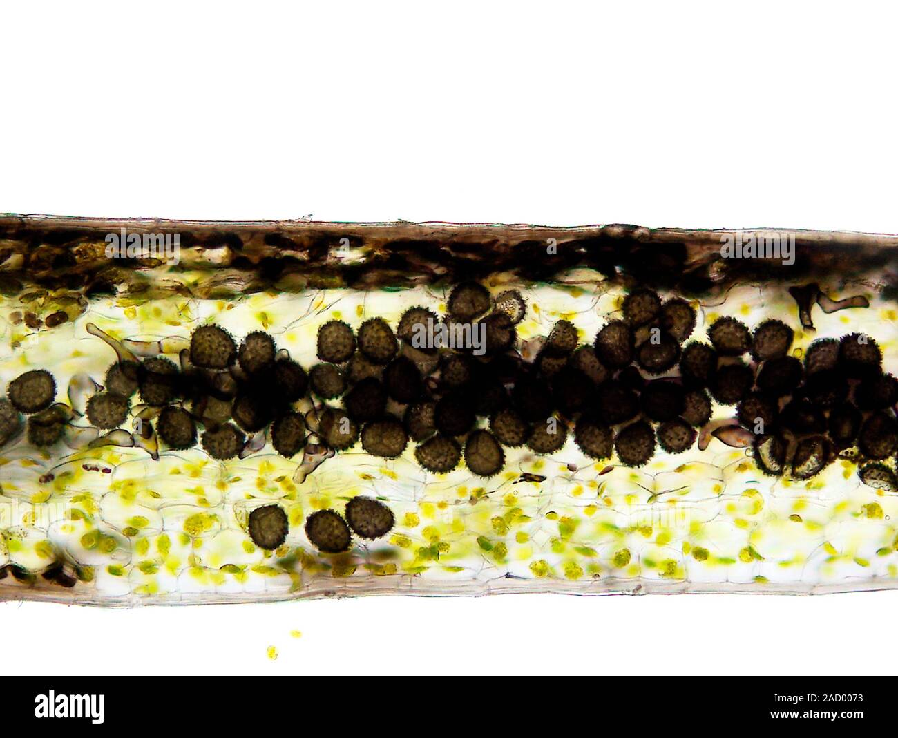 Hornwort sporocytes. Light micrograph of a longitudinal section through ...