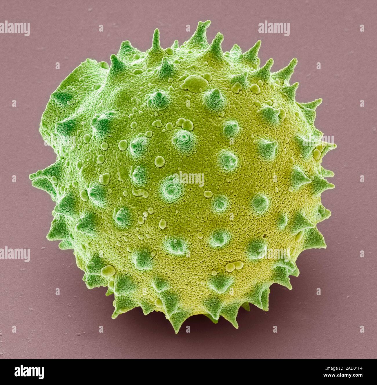 Foraminiferan, coloured scanning electron micrograph (SEM ...