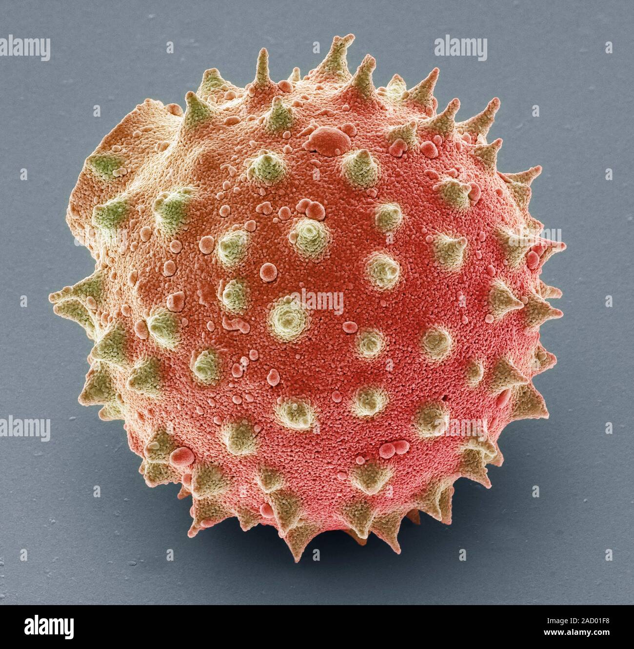 Foraminiferan, coloured scanning electron micrograph (SEM ...