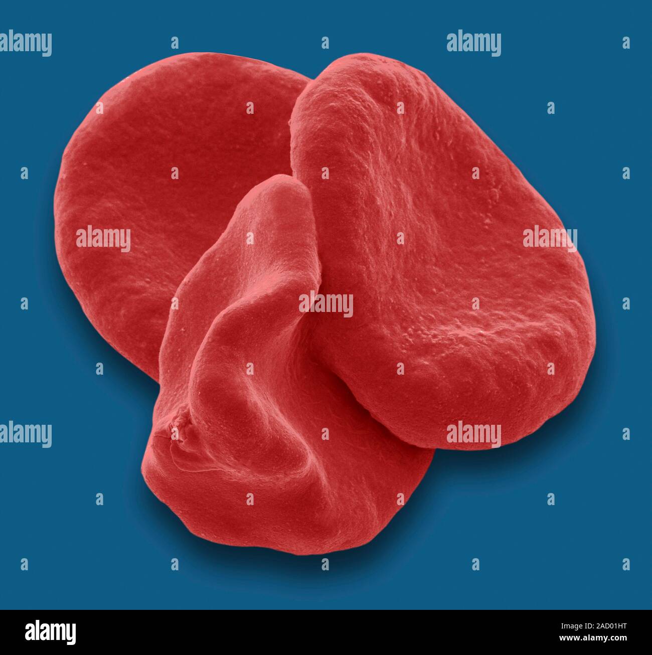 Red blood cells. Coloured scanning electron micrograph (SEM) of red ...