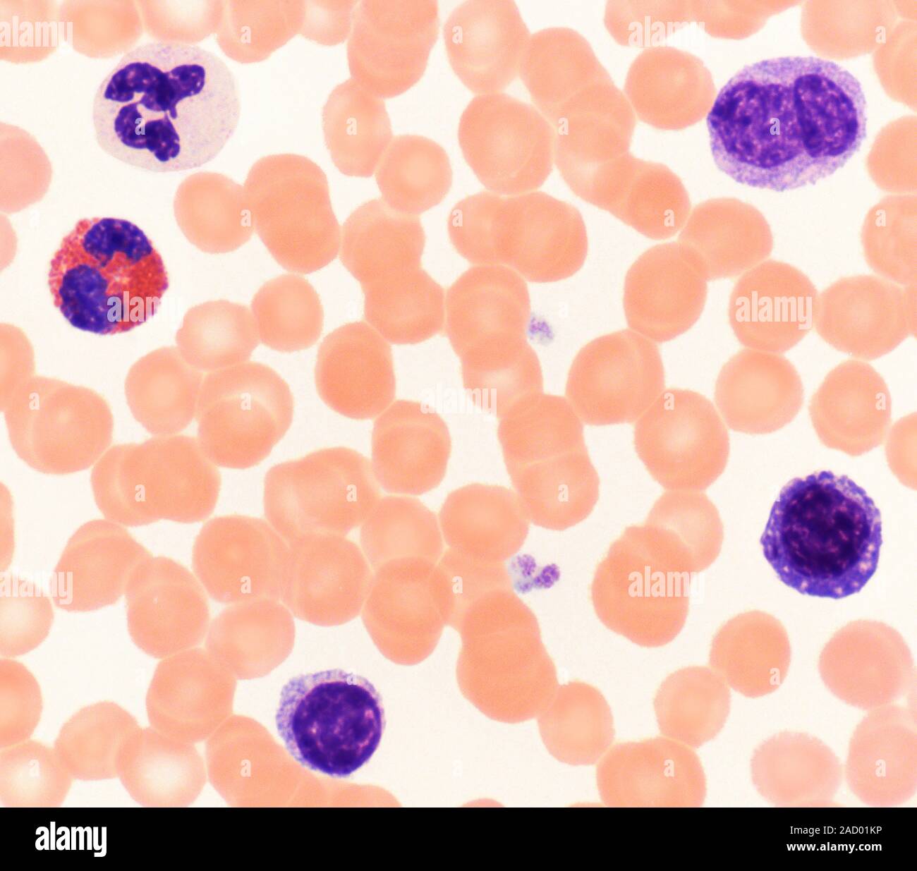 Light microscopy of a normal human blood smear showing the five types ...