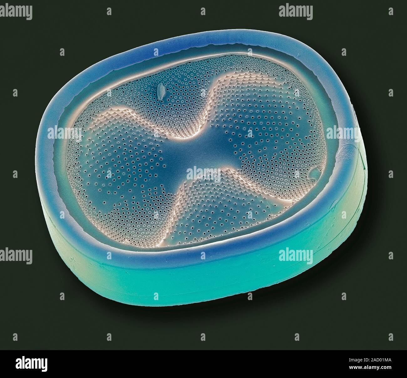 Diatom. Coloured scanning electron micrograph (SEM) of a single diatom ...