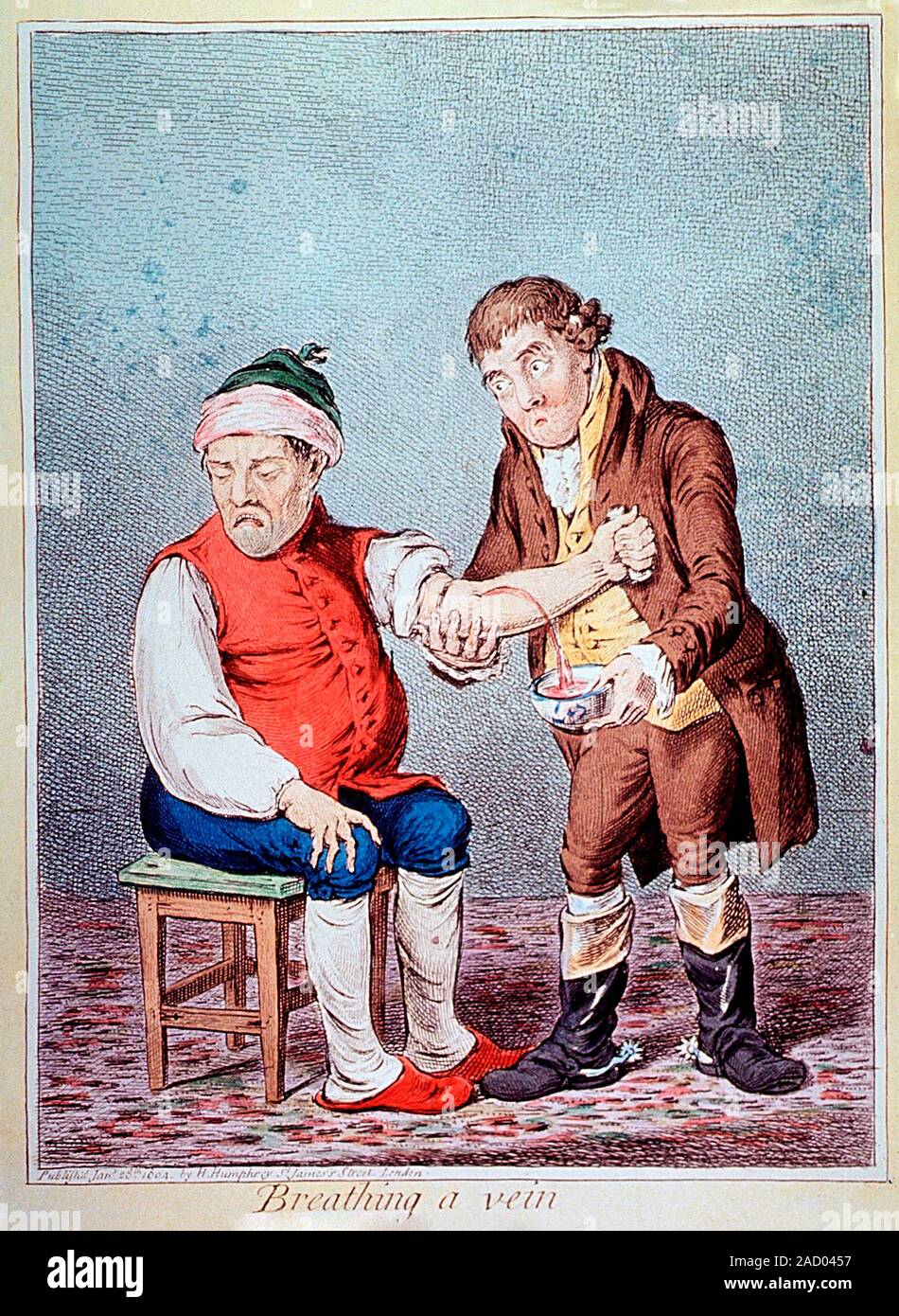 Blood-letting treatment. 19th-century illustration titled 'breathing a ...