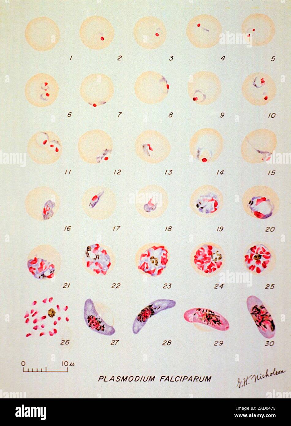 Malaria parasite life cycle, illustration. Malaria is a disease ...