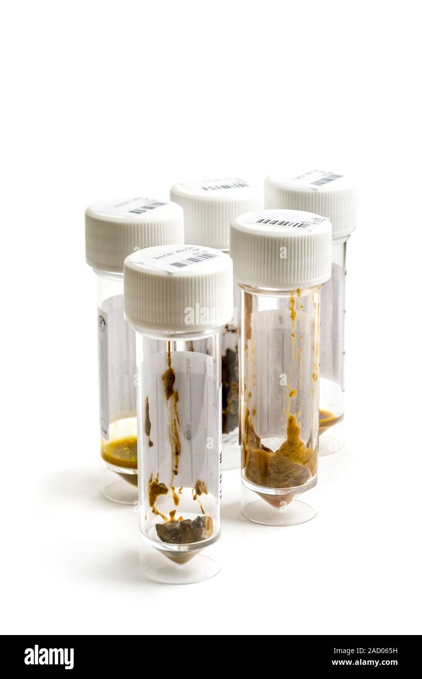 Faecal samples for analysis. Universal pots containing samples of human ...