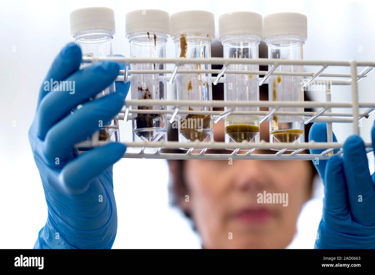 Faecal samples analysis. Lab technician holding a rack of universal ...