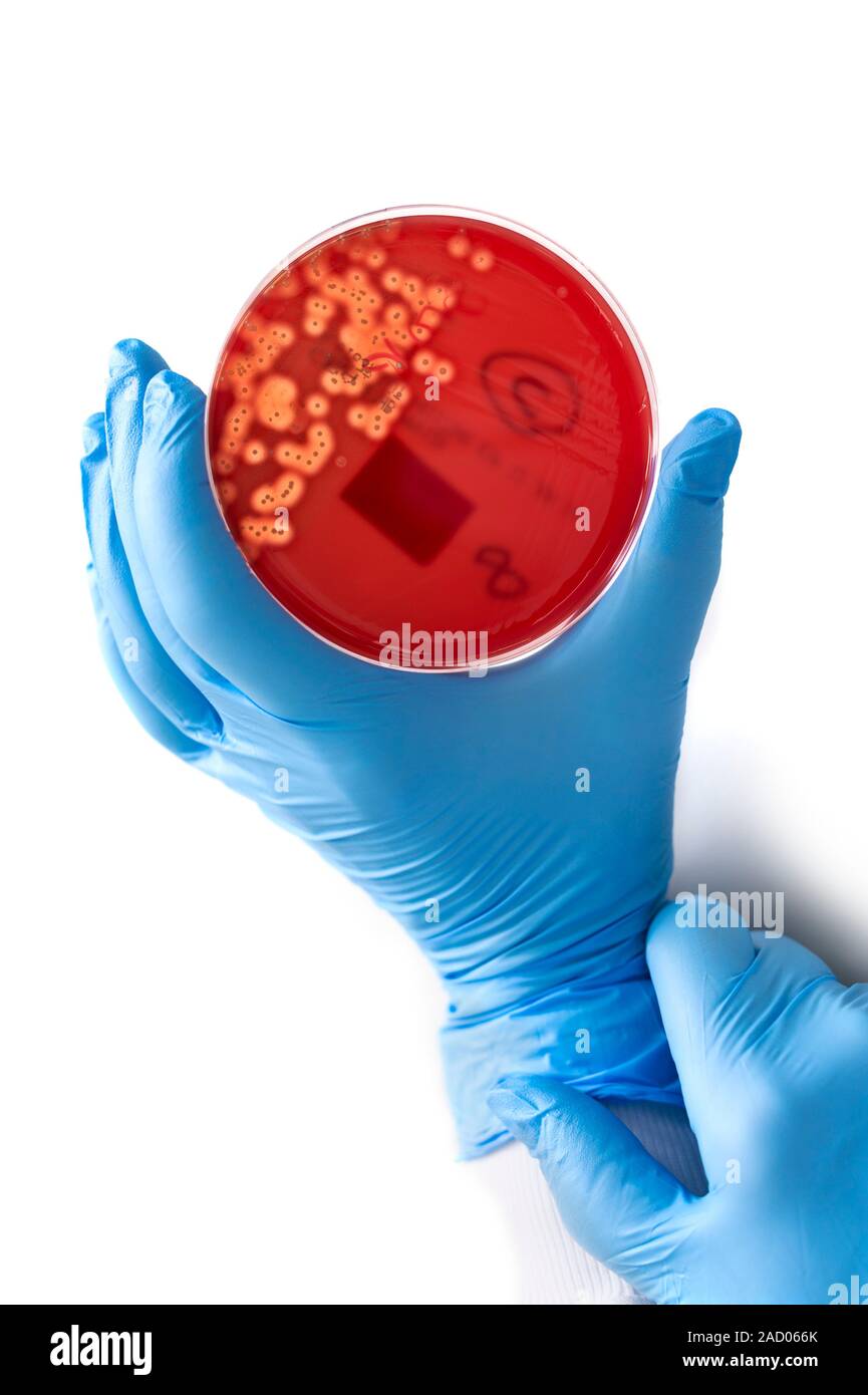 Cultured Streptococcus bacteria. Haemolytic Streptococcus sp ...
