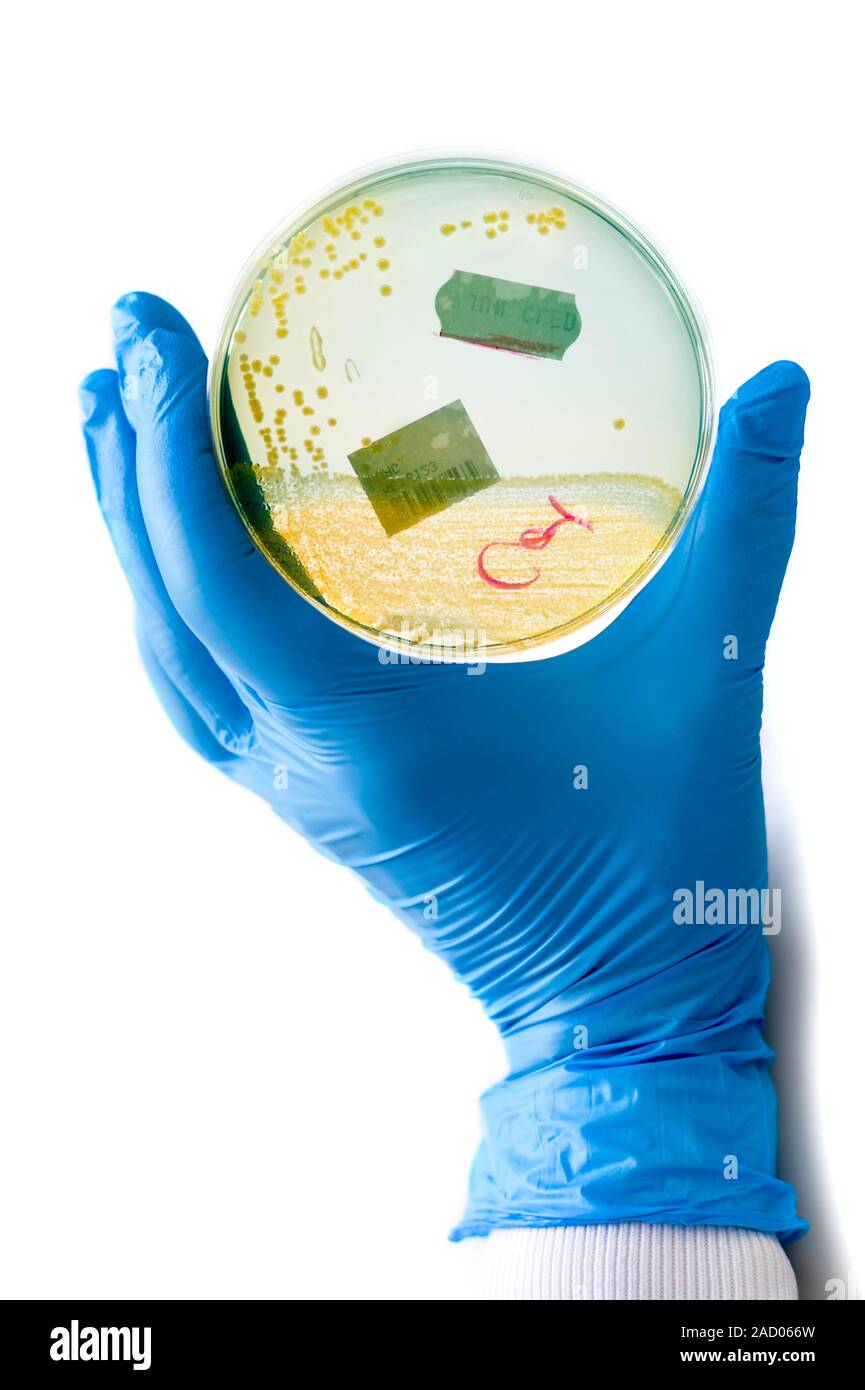 Cultured urinary bacteria. Coliform bacteria from a urine sample ...