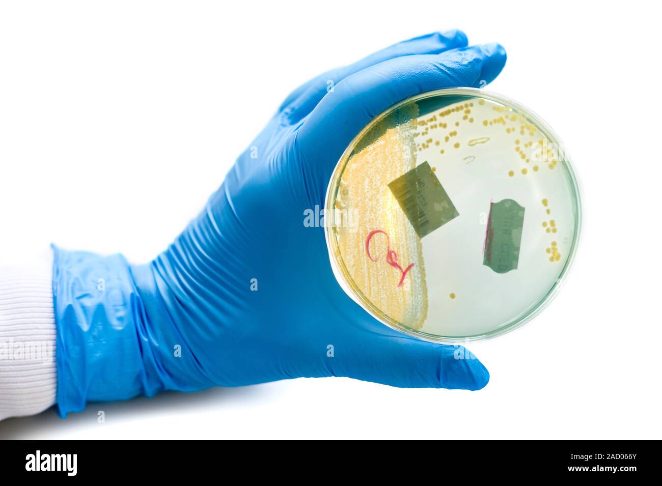 Cultured urinary bacteria. Coliform bacteria from a urine sample ...