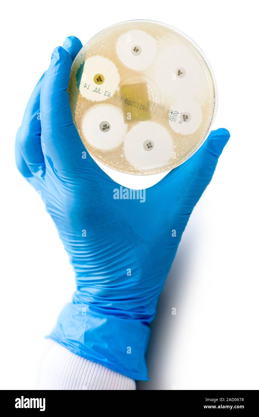 Antibiotic sensitivity test. Coliform bacteria from a urine sample ...