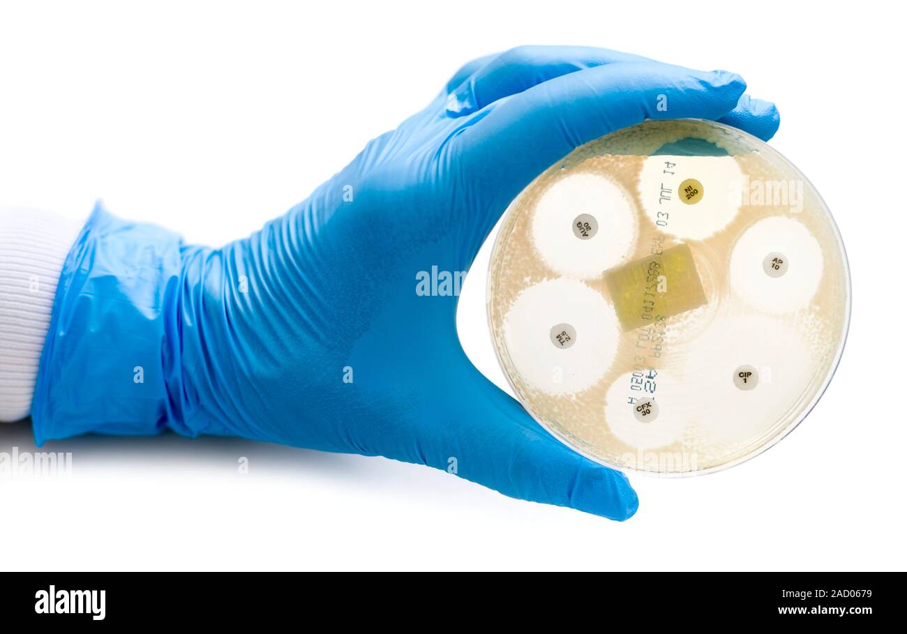 Antibiotic sensitivity test. Coliform bacteria from a urine sample ...
