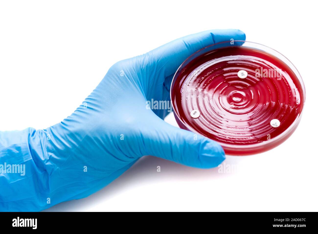 Antibiotic sensitivity test. Campylobacter sp. bacteria growing on agar ...