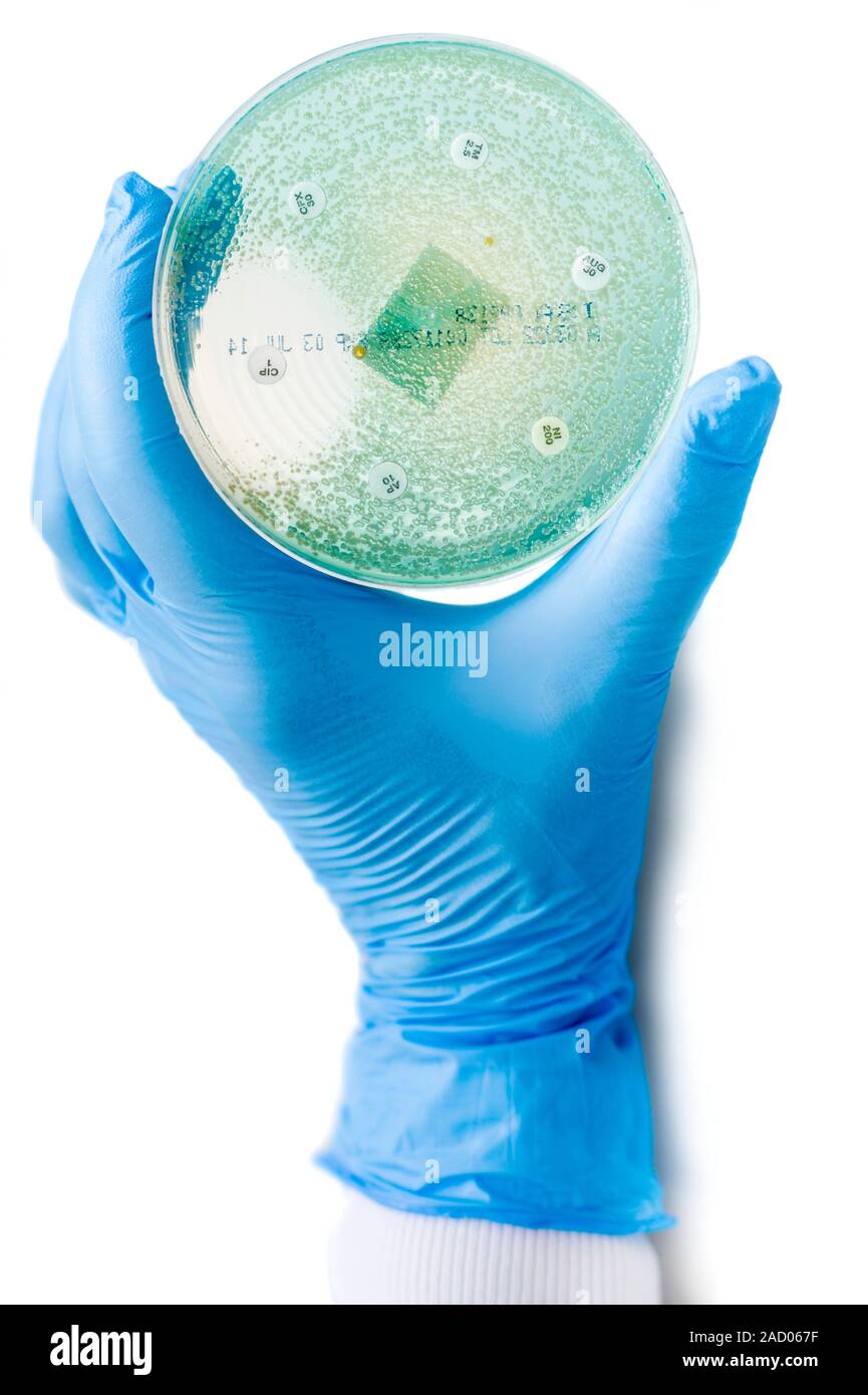 Antibiotic sensitivity test. Pseudomonas aeruginosa bacteria (green ...