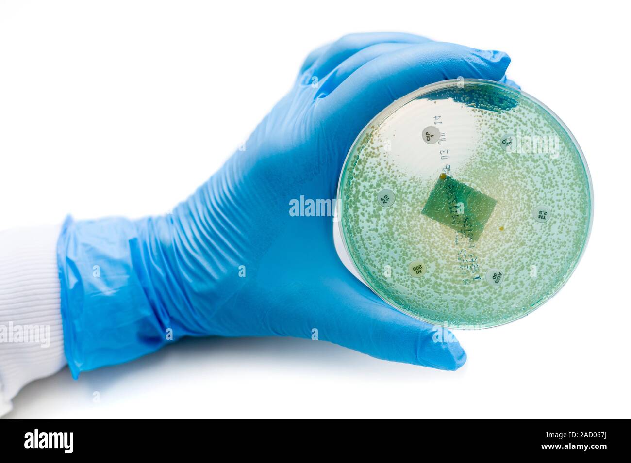 Antibiotic sensitivity test. Pseudomonas aeruginosa bacteria (green ...