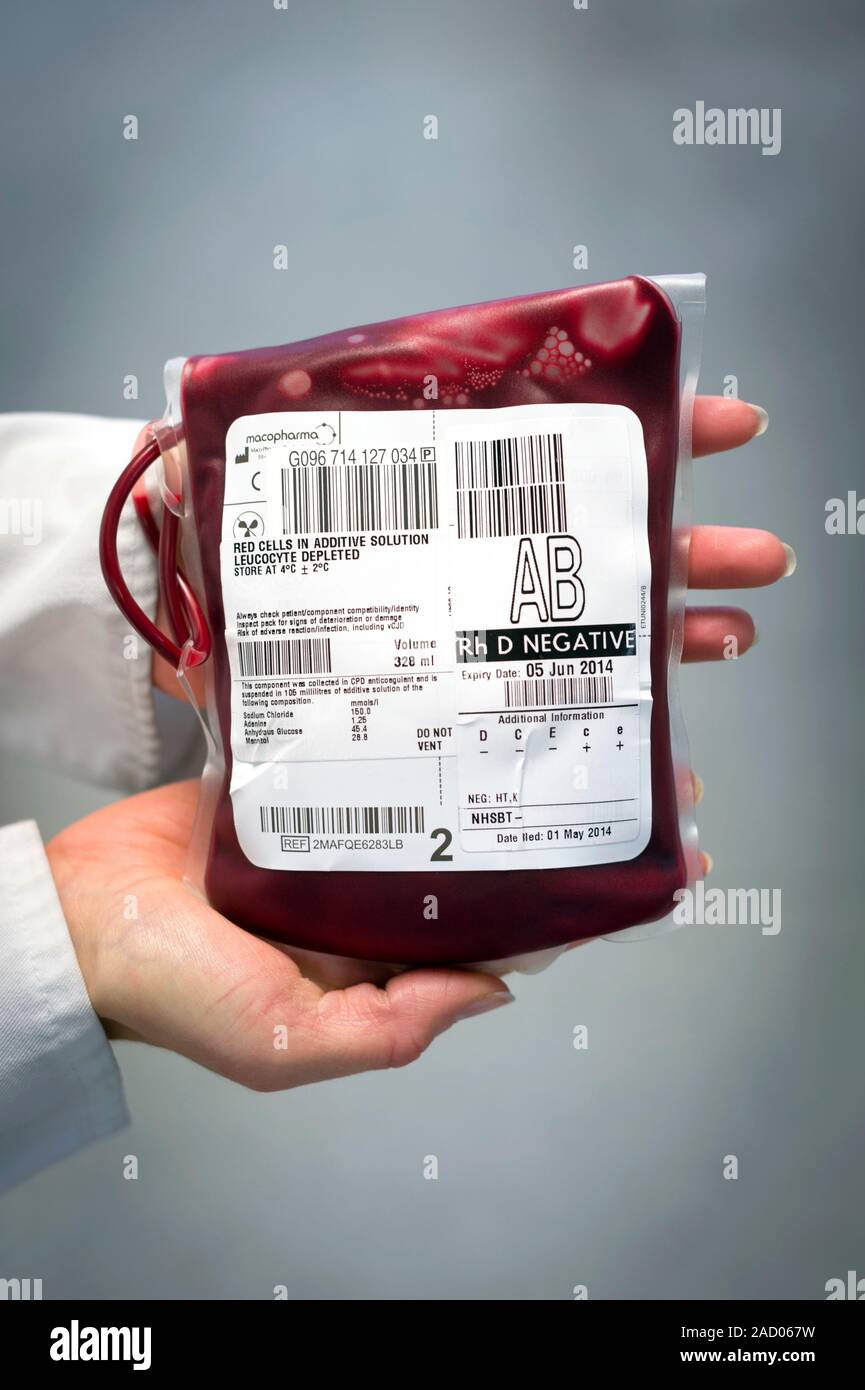 Donated blood. Medical staff member holding a bag of type AB Negative ...