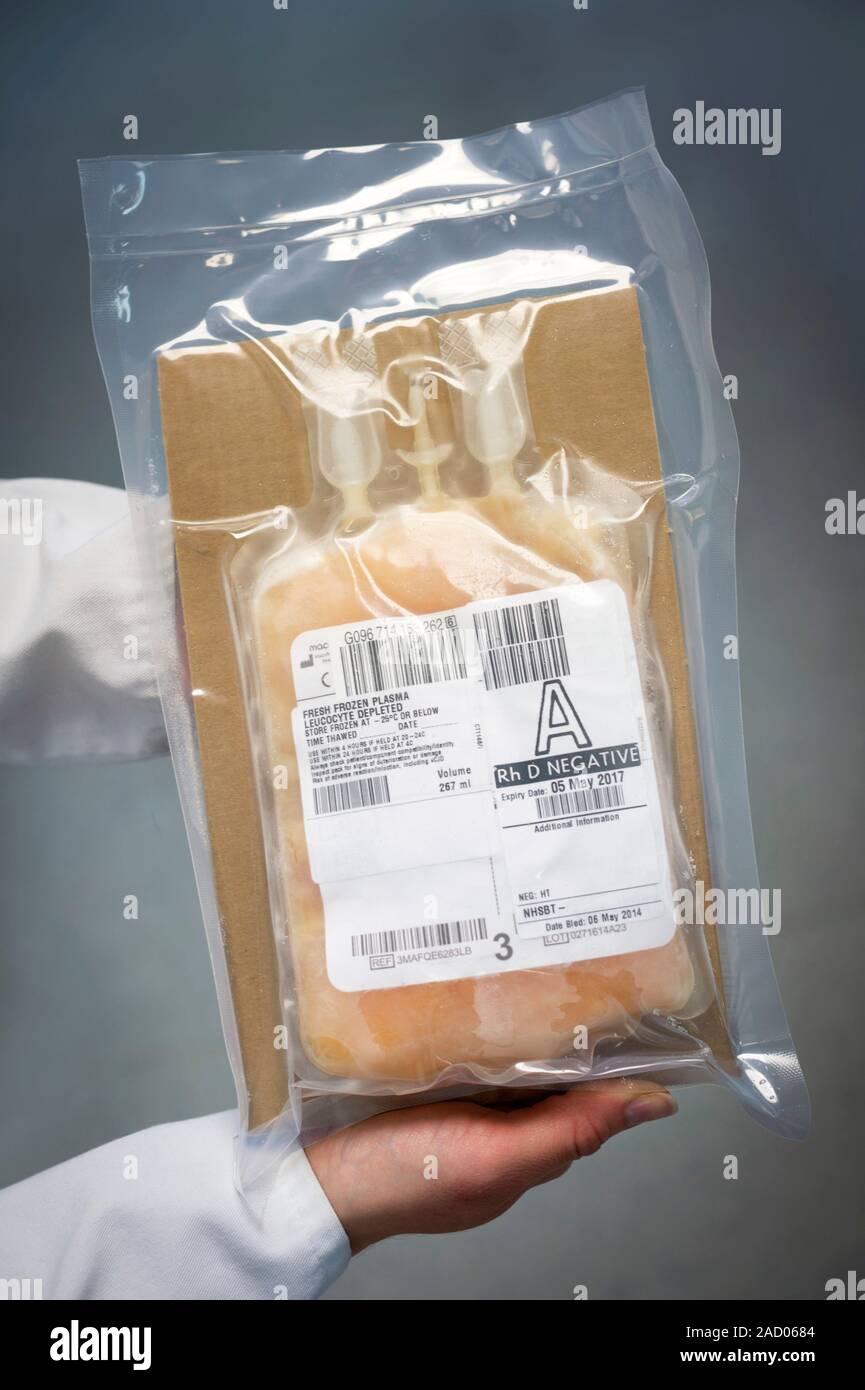 Donated blood plasma. Medical staff member holding a bag of type AB ...