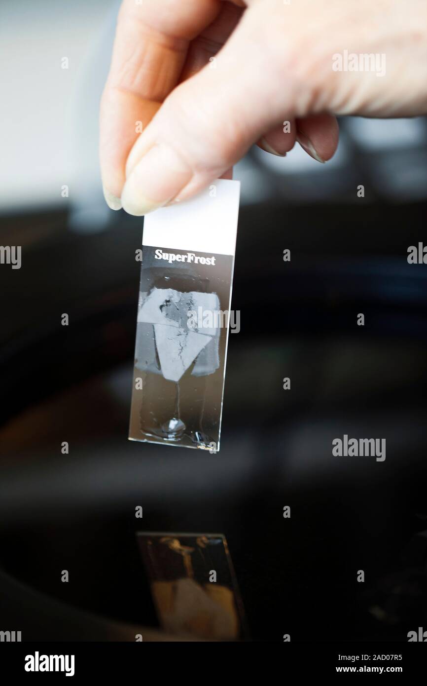 Sperm whale tissue analysis. Microscope slide with tissue rom a dead ...