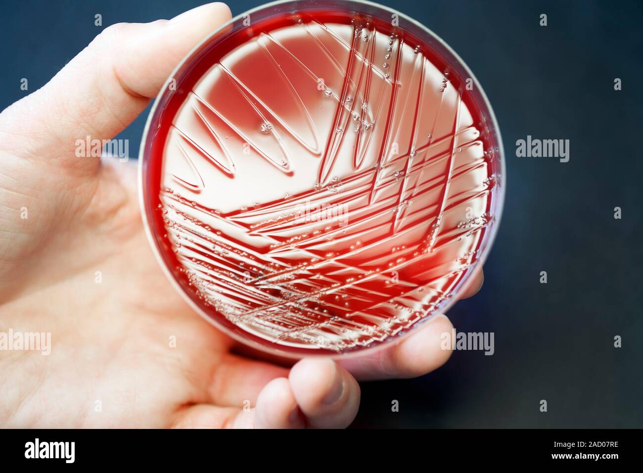Sperm whale bacteria analysis. Petri dish culture of Clostridium ...