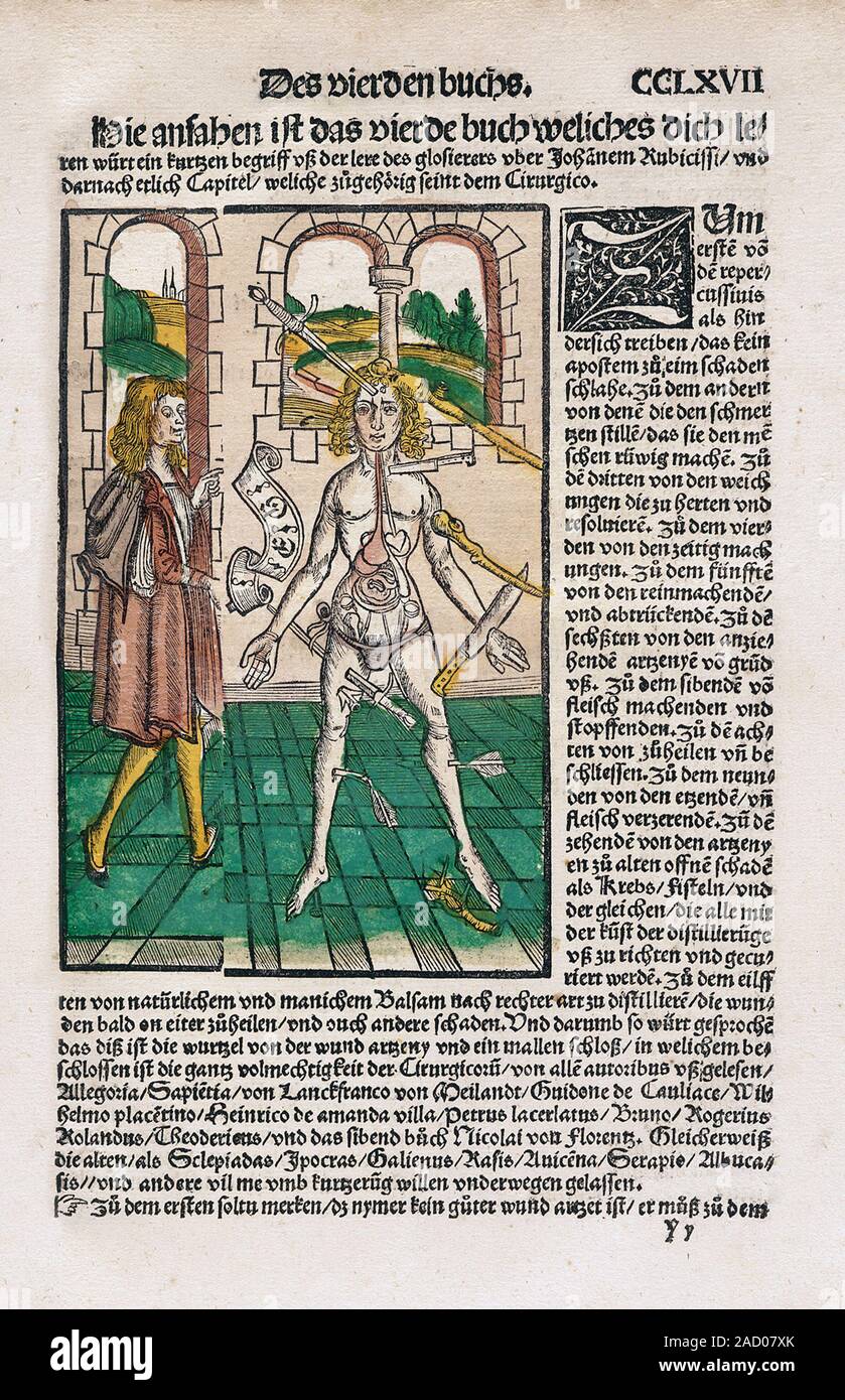 Wound Man and alchemy. 16th-century illustration of an alchemist's ...